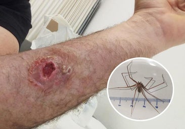 La Venenosa Araña Violinista Ataca En Bizkaia El Correo